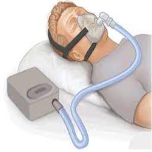 BiPAP, CPAP, Anti Snoring Devices on Rent or Purchase in Delhi NCR